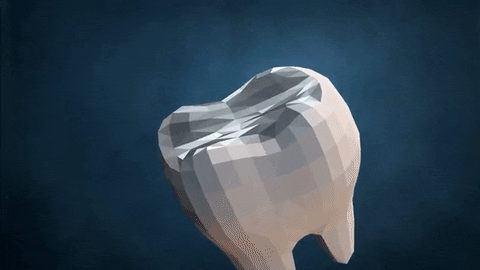 Dental Amalgam GIFs - Get the best GIF on GIPHY