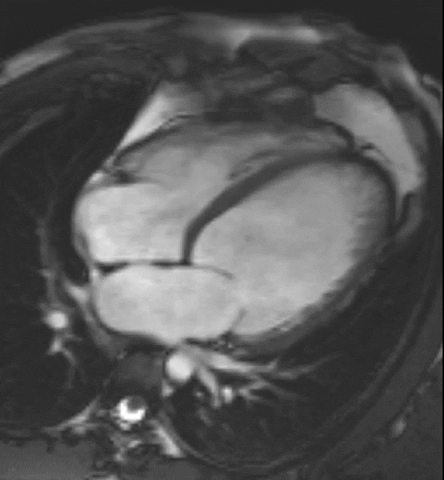 Heart Resonance GIFs - Get the best GIF on GIPHY