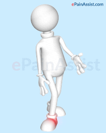 Ankle Sprain GIFs - Get the best GIF on GIPHY