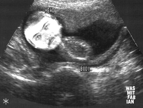 Ultrasound Month GIFs - Find & Share on GIPHY