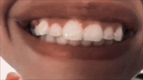 Teeth GIF by Alessia Cara - Find & Share on GIPHY