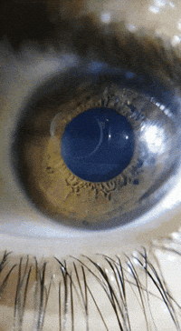 Pupils Dilated Gif