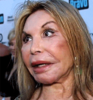 Botox Face GIFs - Get the best GIF on GIPHY