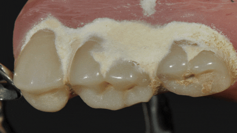 Prothese GIFs - Get the best GIF on GIPHY