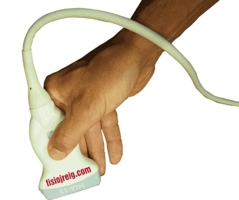 How artificial intelligence is helping to detect heart disease in ...