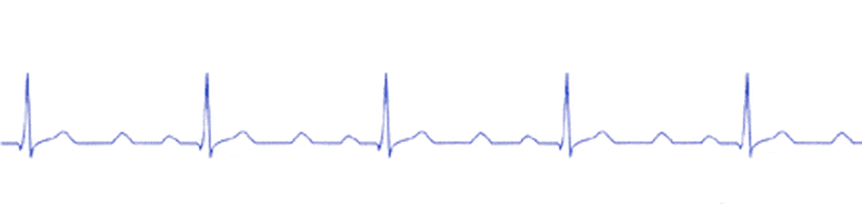Ekg GIFs - Find & Share on GIPHY