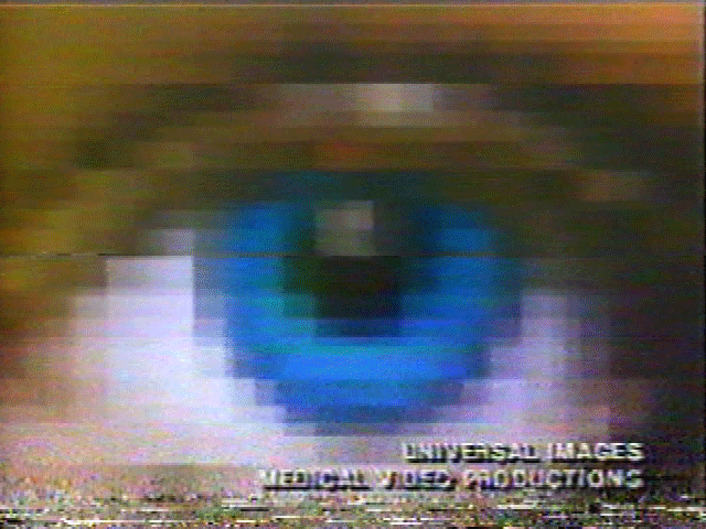 Static Eye GIF by Royal Smith - Find & Share on GIPHY