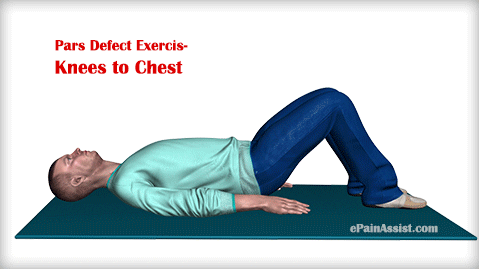 Pars Defect Exercise GIFs - Get the best GIF on GIPHY