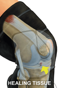 Injury GIFs - Find & Share on GIPHY